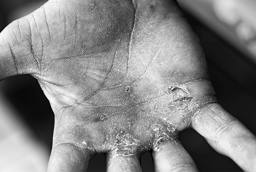 A Guide To CrossFit Hand Protection - Ripped Hands: Causes & Prevention ...